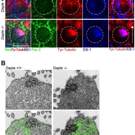 Eb 1tyr Tubulin Staining And Transmission Electron Microscopy 532