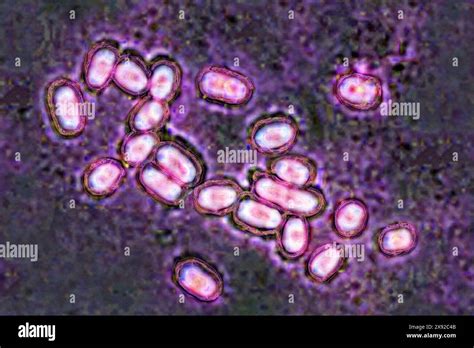 Pneumococcus Streptococcus Pneumoniae Pneumococcus Is A Bacteria