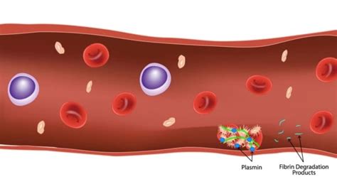 Hemostasis Physiology Stages Key Players And Disorders