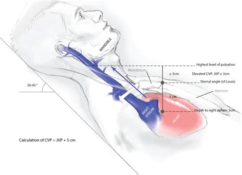 Jugular Venous Pressure Jvp Exam Madeline M Lee