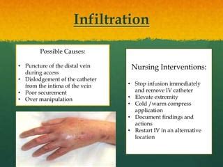 Iv Infiltration