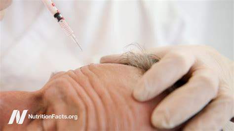 The Efficacy Safety And Side Effects Of Botox And Facelifts