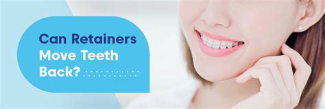 Can Retainers Move Teeth