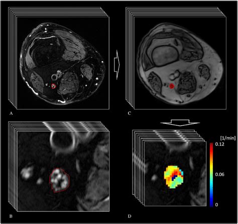 The Process Of Image Segmentation And Co Registration A Position Of Download Scientific