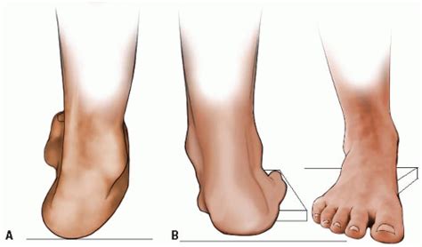 The Foot Musculoskeletal Key
