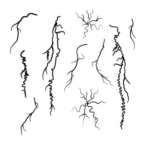 Premium Vector Varicose Veins Anatomy