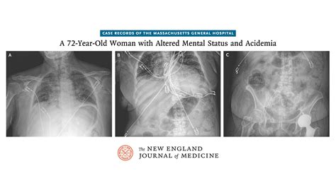 The New England Journal Of Medicine Case Record Of The Massachusetts