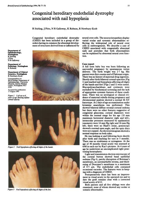 Congenital Hereditary Endothelial Dystrophy Histology