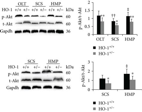 Partial Loss Of Ho 1 Inhibits Activation Of The Hgf Akt Signalling