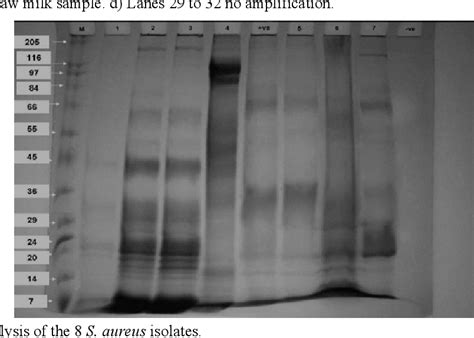 Figure 2 From Rapid Method For Detection Of Staphylococcus Aureus Enterotoxins In Food