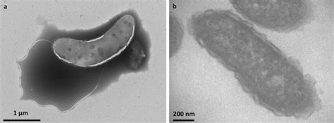 Transmission Electron Micrographs Of Strain Ft415t A Negative