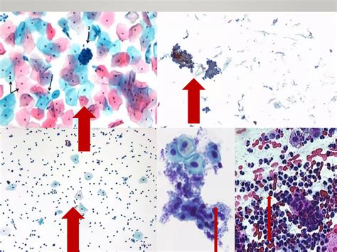 Bethesda System For Reporting Dr Abhinav Golla Associate Professor Lab Director