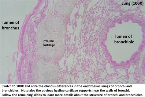 Lung Slide Bronchiole