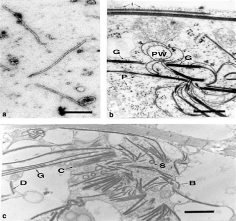 Electron Micrographs Of Preparations From Joyweed Plants Infected With