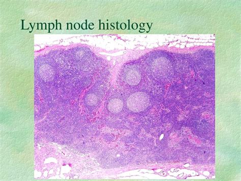 Pathological Lymph Node Subtitlejohn