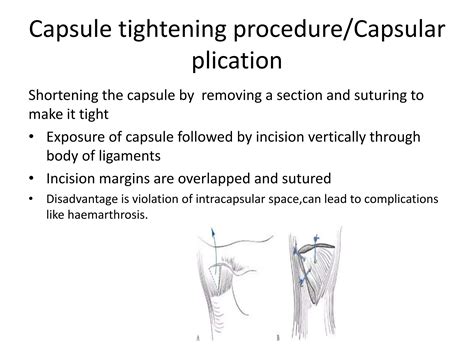 Clinical Features Presentation Clinical And Surgical Management Of Tmj Dislocation Ppt