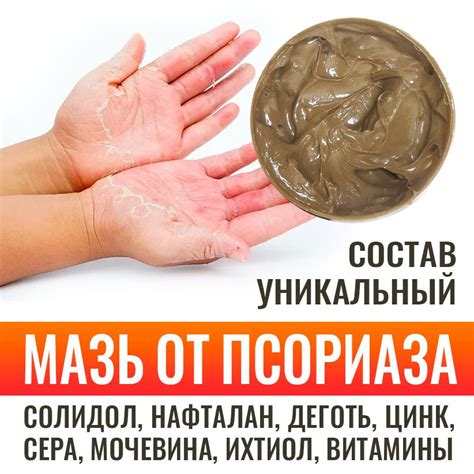 Мазь солидоловая 100гр с дегтем, цинком, серой, мочевиной, салициловой ...