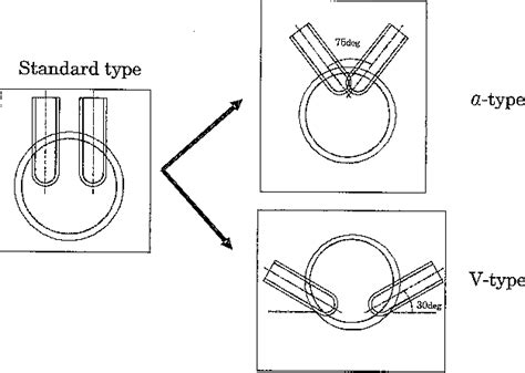 Figure 2 From Development Of A New Pulsatile Ventricular Assist Device Semantic Scholar