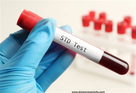 Sexually Transmitted Diseases Std Venereal Diseases Aids