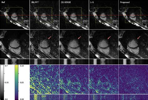 Figure 2 From Neural Implicit K Space For Binning Free Non Cartesian Cardiac Mr Imaging