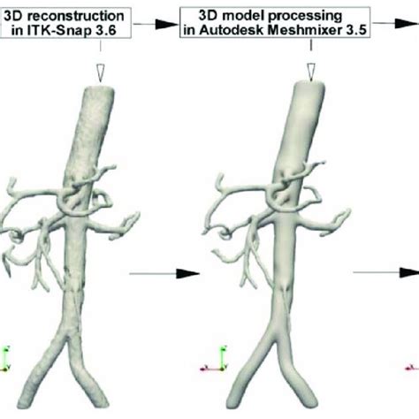 3d Model Reconstruction Based On The Dicom Images Acquired During The