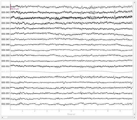 Setting The EEG Reference MNE Documentation