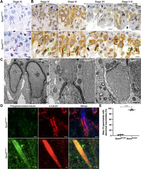 Spastin Is A Key Regulator Of Manchette Structure And Dynamics A