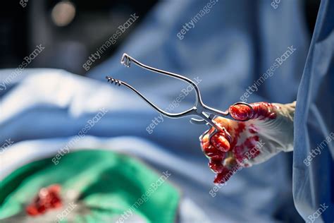 치료 사건 의학 과학 의료진단도구 모니터링장비 의료보험 보험 수술 치료 수술도구 의료기기 의사 치료 병원 의료시설 이미지