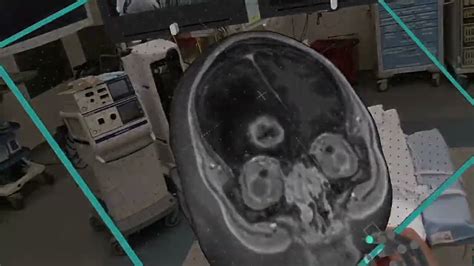 Augmented Reality Surgery Is Real And Amazing