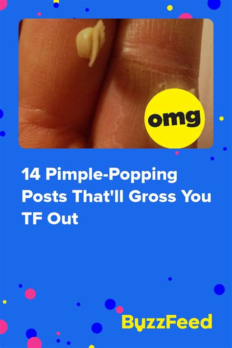 Zit Popping Video Faces Artofit