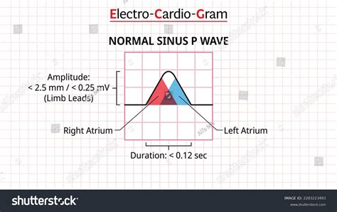 P Wave Ecg Sinus Normal Electrocardiogram Stock Vector Royalty Free