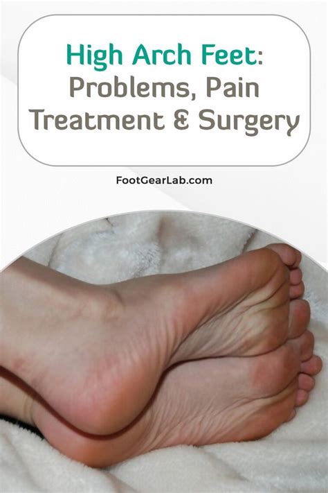 Dislocated Toe Symptoms Causes Treatment And Recovery Time Artofit