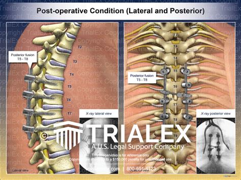 Post Operative Condition