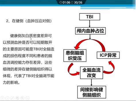 别黎教授基于三维建模定量分析脑灰白质密度差异评估急性硬膜下血肿转归 脑医汇