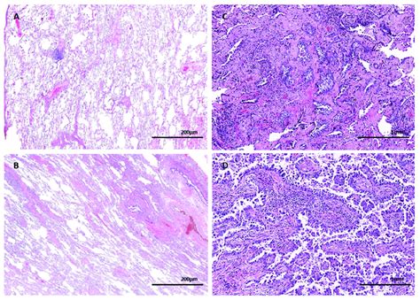 Graphical Representation Of The Mutation Type Identified For Both Egfr