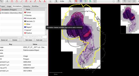 Annotations Displaced When Opening Saved Qpdata File · Issue 6244 · Omeopenmicroscopy · Github