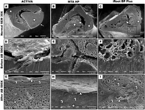 SEM Morphological Analysis Of The Materials Bone Interface At Download Scientific Diagram