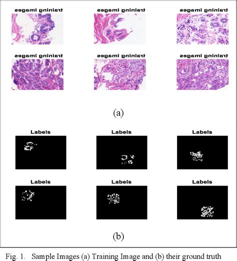 figure 1 from breast cancer cell segmentation using attention based