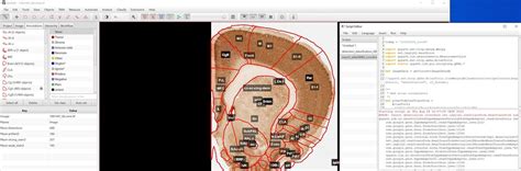 Lack Of Atlas Coordinates For Hemispheres In Qupathabba Usage