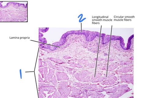 Urinary Bladder And Ureter Histology Flashcards Quizlet