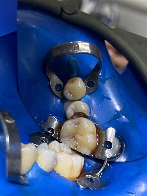 Shehab Naser On Linkedin Restorative Workflow