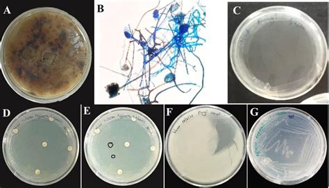 Isolation Of Endo Bacteria From Fungal Mycelia A Rhizobium Species In