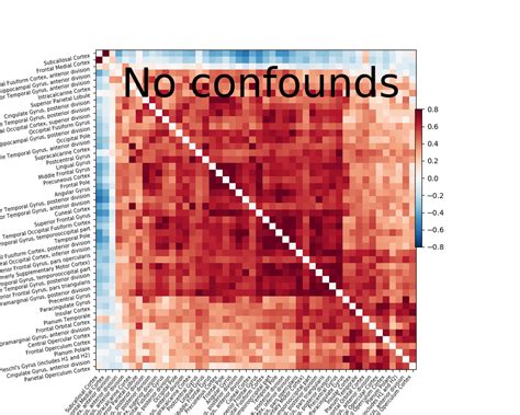 Nilearn Statistical Analysis For Neuroimaging In Python — Machine