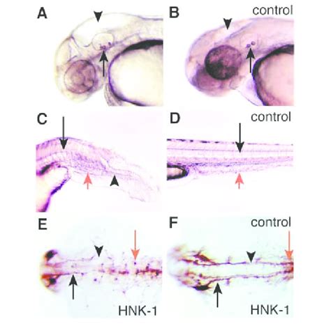 Neurological Effects Of Runx1 Depletion Morphological Phenotype A D Download Scientific