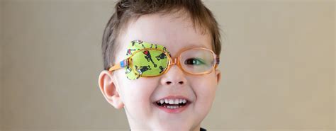 Understanding Lazy Eye Causes Symptoms And Treatments Mexdf Magazine