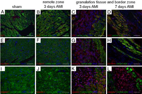 Formation Of The In Fl Ammasome In The Granulation Tissue And