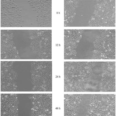 The Number Of Migration Cells In Transwell Chamber Assay The Results