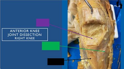 Anterior Knee Region R Joint Dissection Lab Diagram Quizlet