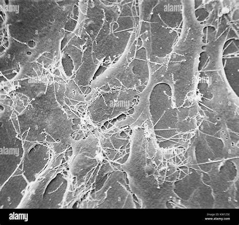 Cytoskeleton Electron Micrograph