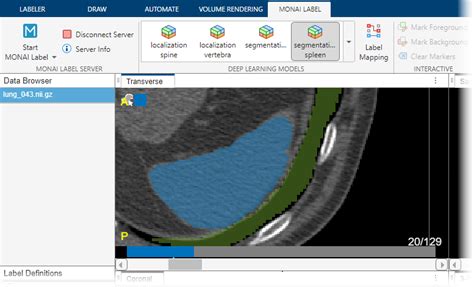 segment ct scan using monai label matlab and simulink